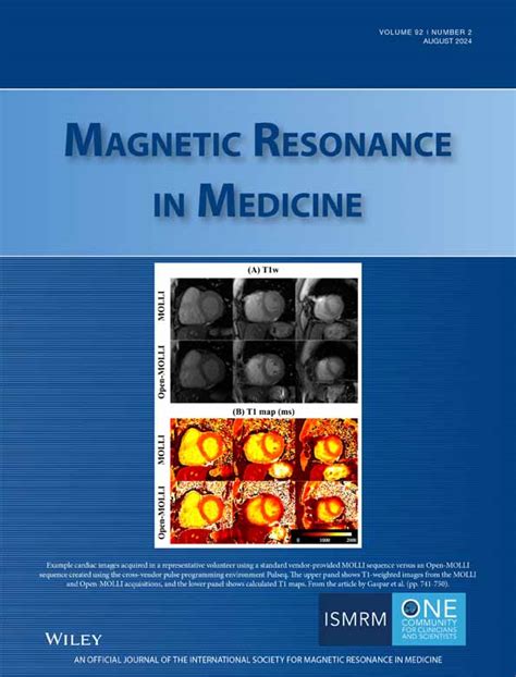 Highly‐accelerated Cest Mri Using Frequency‐offset‐dependent K‐space