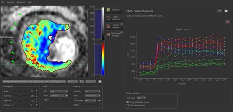 Multi Voxel Analysis