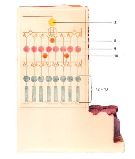 Retina 3 Diagram Quizlet