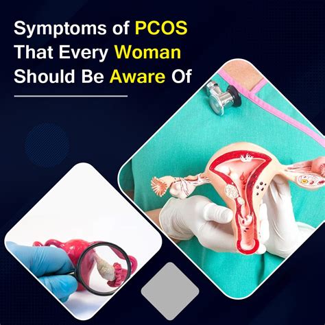 Symptoms Of Pcos That Every Woman Should Be Aware Of By Deepali Anand