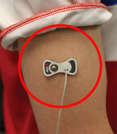 The Next Level Of Health Monitoring Could Interstitial Fluid Replace