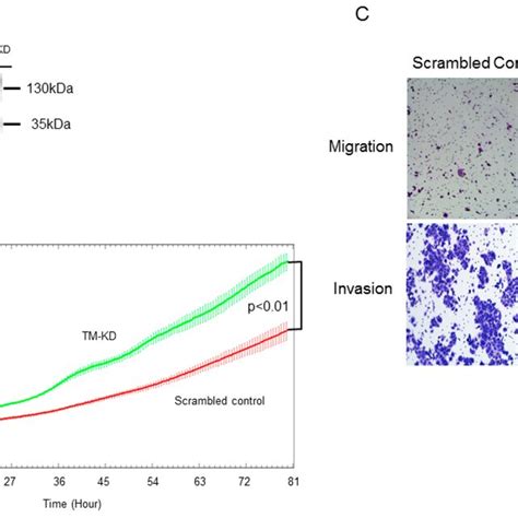 Silencing Tm Promoted Malignant Progression Of Er⁺ Breast Cancer Cell