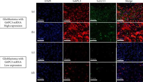Identifying G6pc3 As A Potential Key Molecule In Hypoxic Glucose
