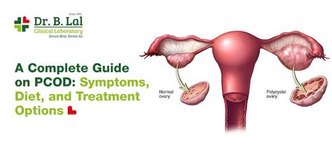 Pcod Complete Guide Symptoms Diet And Treatment Options Dr Blal
