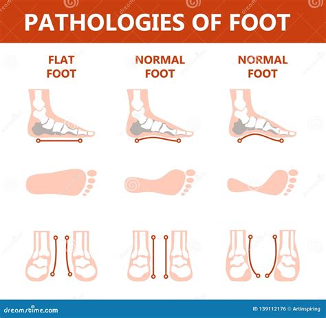 Healthy Foot Structure