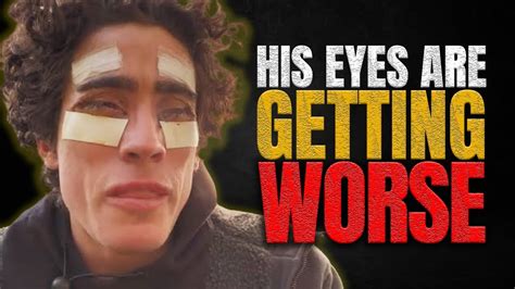 Cosmetic Surgery Fails The Conspiracy Behind Frank Tufanos Botched Eye Surgery Youtube