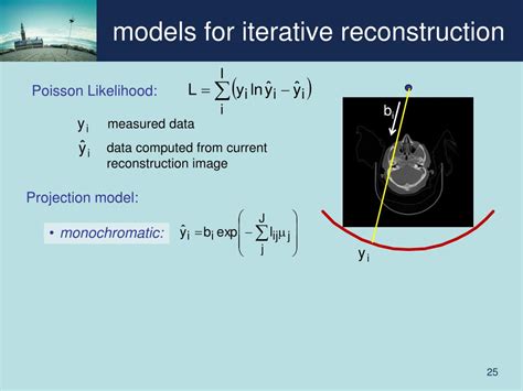 Ppt Iterative Reconstruction For Metal Artifact Reduction In Ct