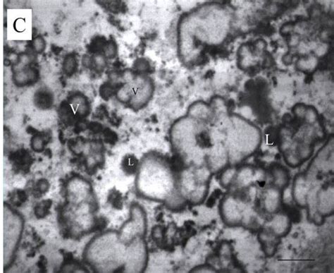 Transmission Electron Microscopy Of E Granulosus Microcysts A