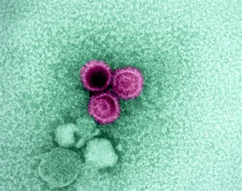 Nih Scientists Find Weak Points On Epstein Barr Virus National