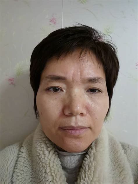 【周明】医生阜宁县人民医院医院网上预约挂号图文问诊电话问诊门诊加号在线问诊京东健康互联网医院