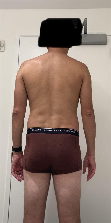 Anterior Pelvic Tilt Radvancedposture