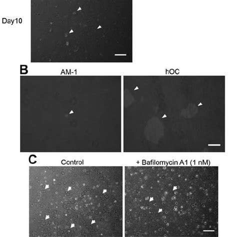 Absorption Pit Formation By Am 1 Cells A Am 1 And Hacat Cells Were