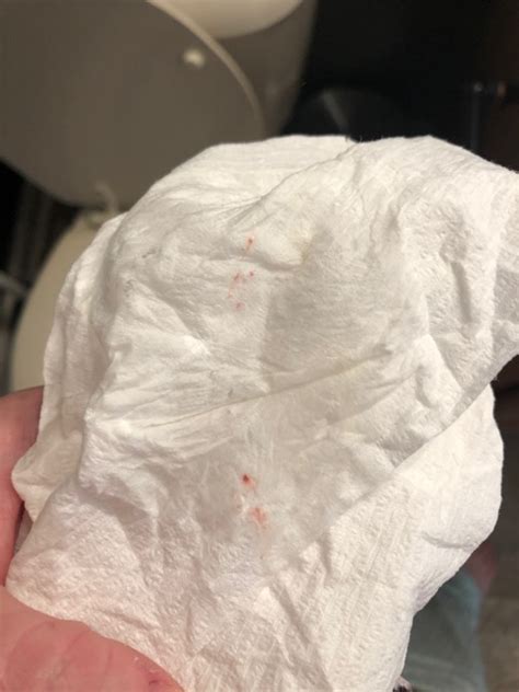 Tmi Implantation Bleeding 12 Dpo When Would A Line Appear Glow