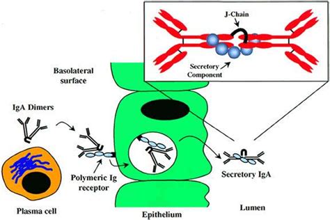 Selective Iga Deficiency Immunology Medbullets Step 1