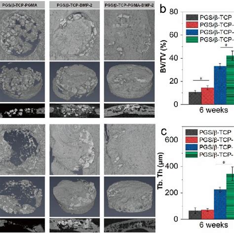 Bone Tissue Regeneration Within Rat Cranial Defect Model After 6 Week Download Scientific