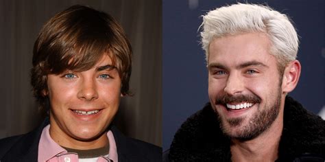 10 Celebrities With Veneers Celebrities Who Had Major Teeth
