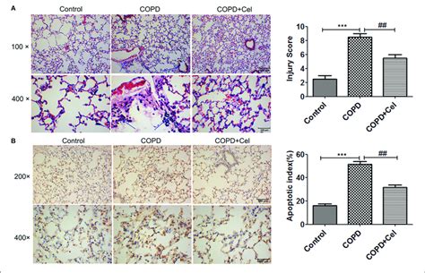 Pathological Examination Of Mouse Lung Tissue A He Staining Of