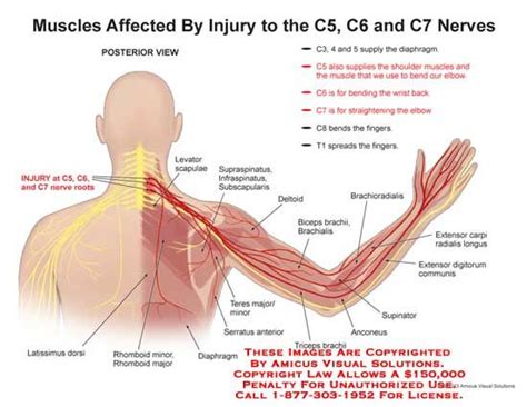 C3 C4 C5 Symptoms Neck Nerves Anatomy C5 C6 Pinched Nerve