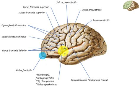 Morfologija Velikog Mozga Površina Mozga I Njegovi Režnjevi