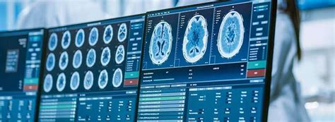 Desafíos De La Imagenología Oncológica Durante La Pandemia De Covid 19