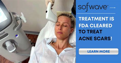 Sofwave On Linkedin Sofwave Medical Announces Fda Clearance Of Superb
