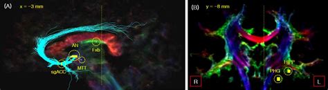 Frontiers Papez Circuit Observed By In Vivo Human Brain With 7 0t Mri