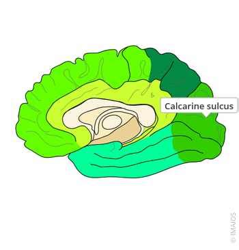 Calcarine Sulcus E Anatomy Imaios