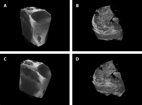 Representative Micro Computed Tomography Specimens For Matched Control