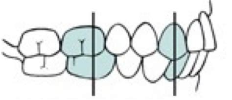 Tooth Positioning Flashcards Quizlet