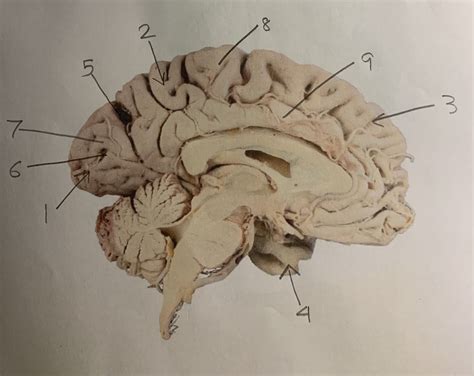 Midline Saggital Cortex Focussed Diagram Quizlet