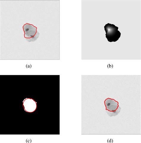 Figure 3 From Segmentation Of Overlapping Cervical Smear Cells Based On U Net And Improved Level