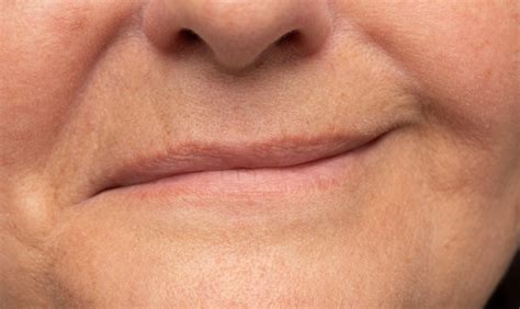 Causes Of Facial Weakness A Complete Overview