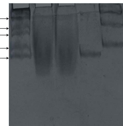 Sds Page Of Partially Purified Xylanase After Gel Exclusion