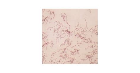 Borrelia Slide Borrelia Recurrentis Infection Spirochetes Were