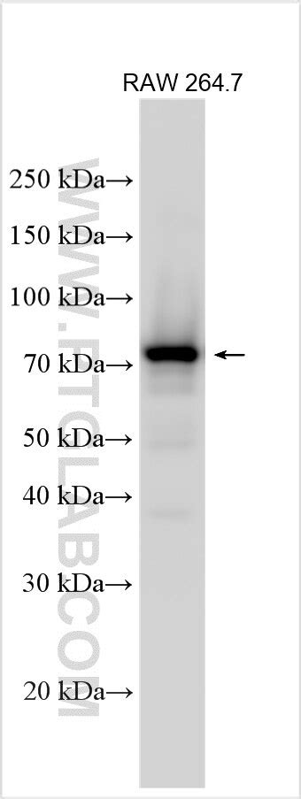 Il 16 Antibody 32611 1 Ap Proteintech