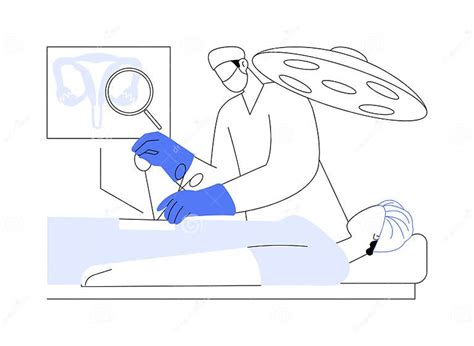 Female Pelvic Laparoscopy Abstract Concept Vector Illustration Stock