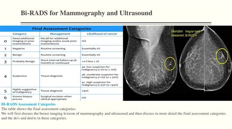 Bi Rads For Mammography And Ultrasound Ky Thuat Y Sinh презентация онлайн