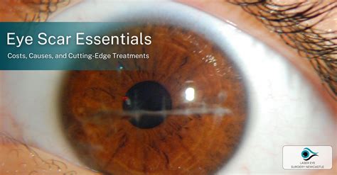 Eye Scar Essentials Costs Causes And Cutting Edge Treatments