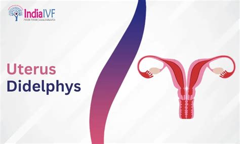 Uterus Didelphys Treatment Diagnosis And Solutions By India Ivf Fertility