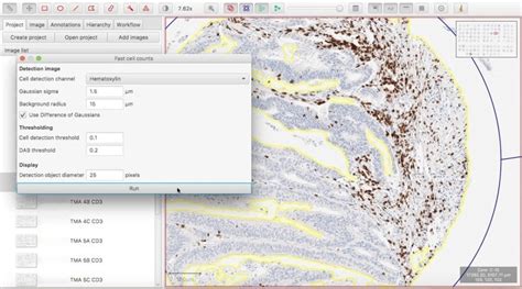 TMA CD Analysis Qupath Qupath Wiki GitHub