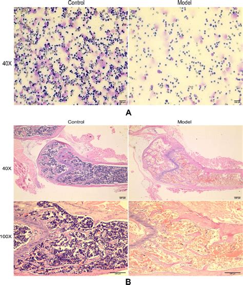 Bone Marrow Proliferation Among Group Control And Model On Day 1