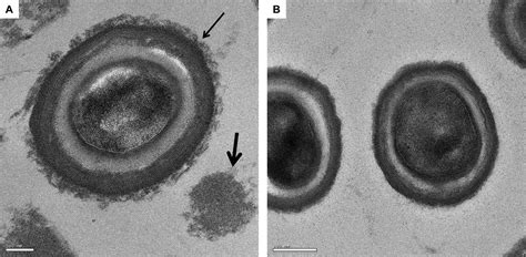 Clostridium Difficile Spores