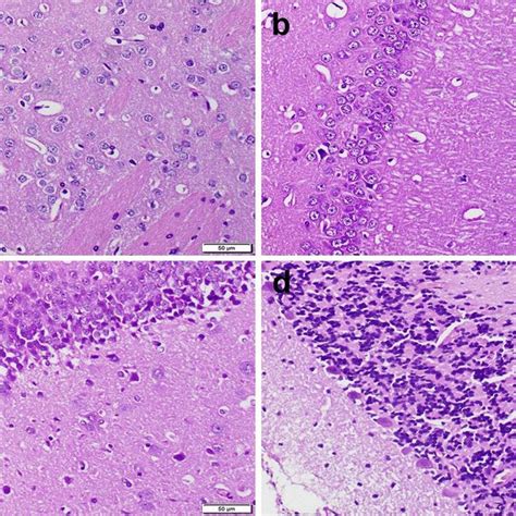 Histaldo Classification Scheme Graphic Depiction Of The Histaldo
