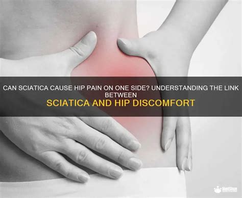 Can Sciatica Cause Hip Pain On One Side Understanding The Link Between