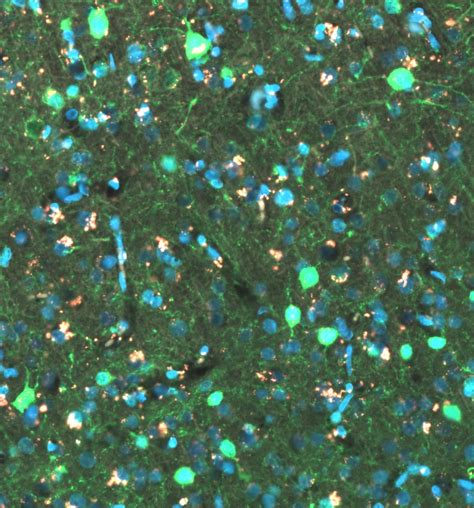 Using Qupath For Rnascope Ihc Colocalization Image Analysis Image