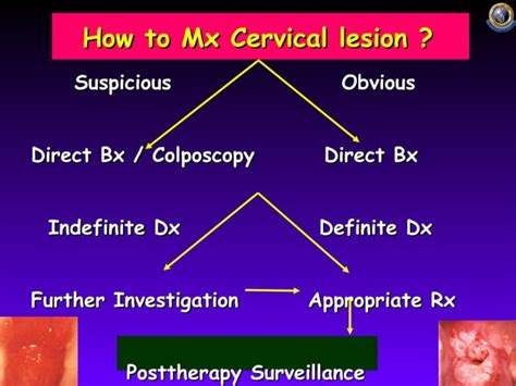 Abnormal Pap Smear ศิริราช Ppt Ppt