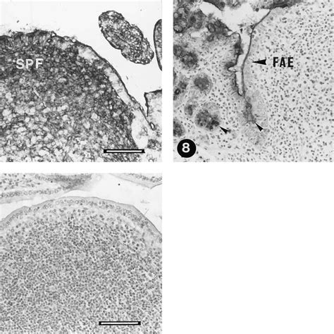 A Cytochemical Control Of A Peyers Patch From An Scid Mouse Sacrificed