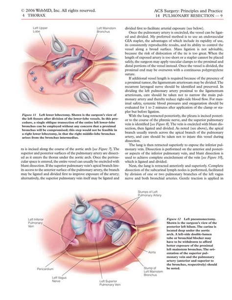 Acs0414 Pulmonary Resection Pdf