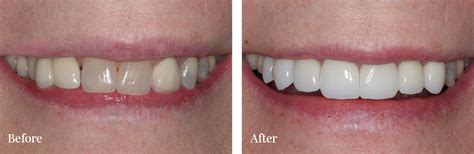 Smile Gallery Asheville Asheville Nc John Highsmith Dds