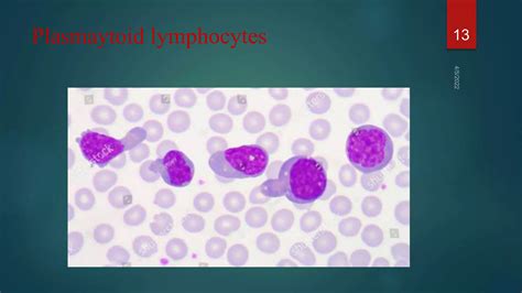 Atypical Lymphocytes Ppt